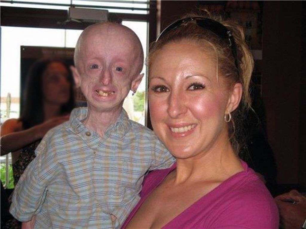 ARGININE VASOPRESSIN RESISTANCE EXPLAINED: A COMPLETE CLINICAL OVERVIEW ...