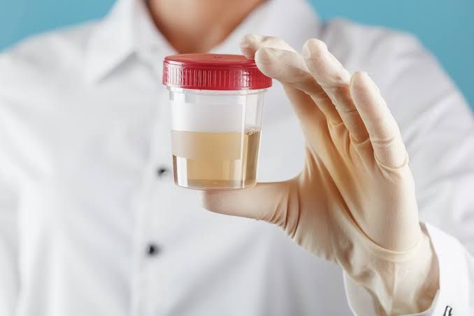 DETECT AND REPORT URINE ABNORMALITIES: EXPERT GUIDE TO PYURIA AND ...