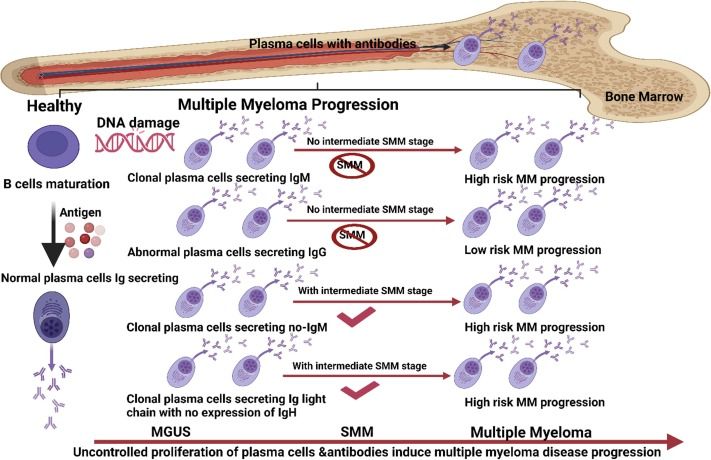 MULTIPLE MYELOMA: UNRAVELING PATHOGENESIS, CLINICAL MANIFESTATIONS, AND ...